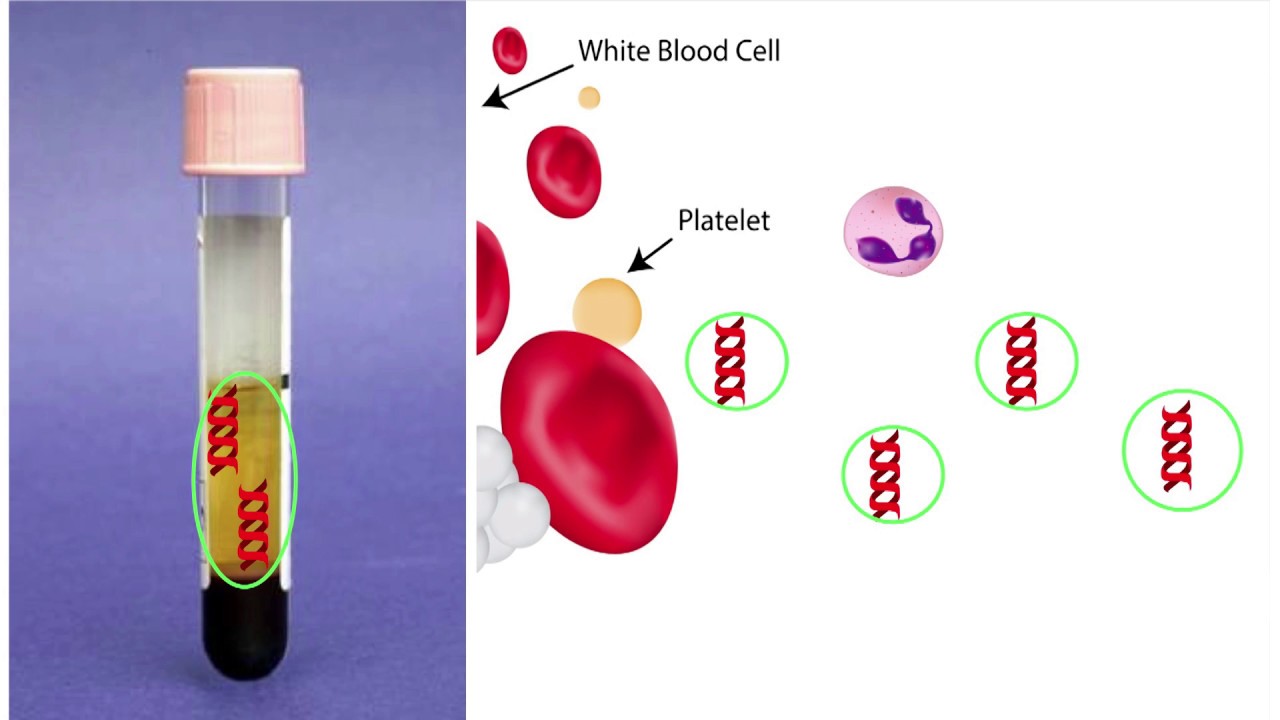 How Liquid Biopsy Can Revolutionise Medical Diagnostics | Dennis Lo ...