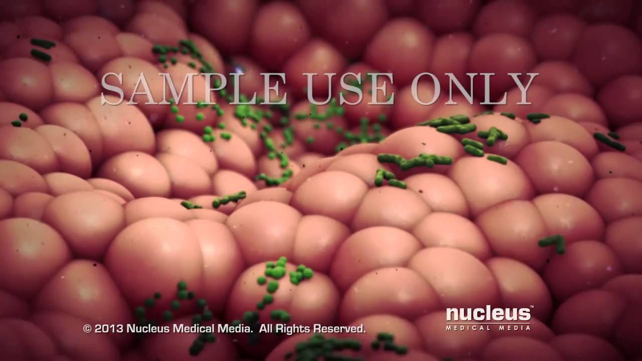 Medical Animation HIV and AIDS 2016 - YouTube