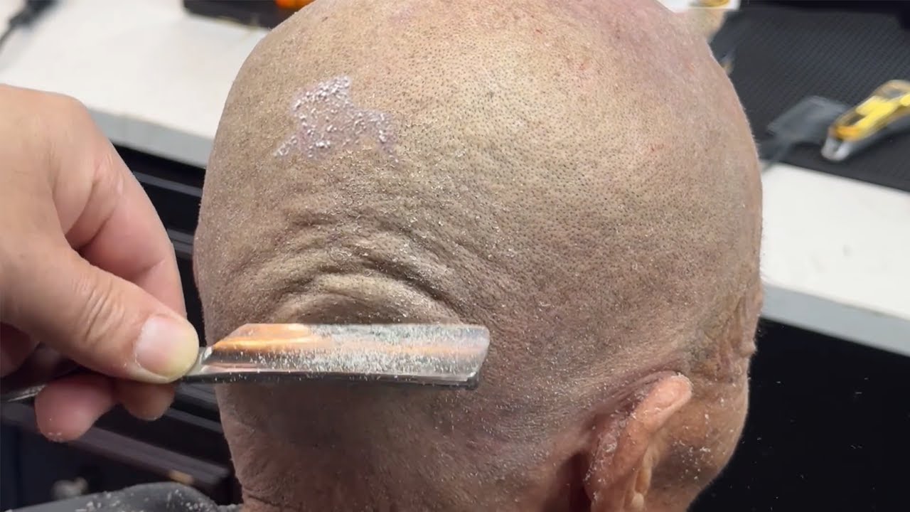 💈ASMR | Remove a lot of dead skin from a man's head and face! 🪒Superb ...