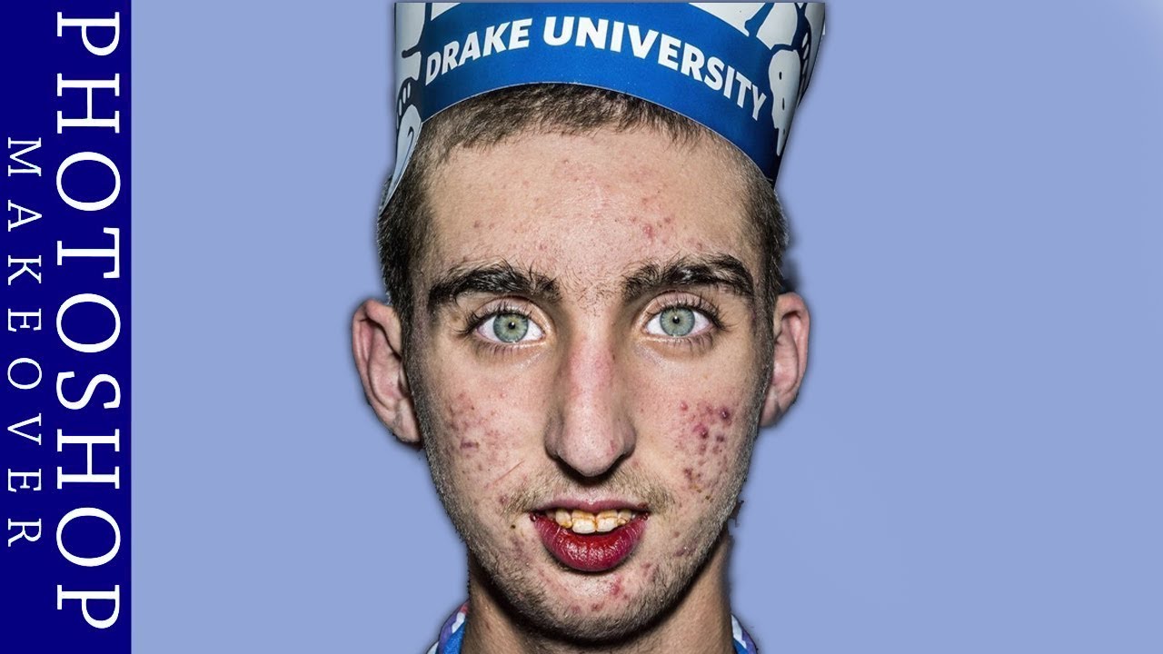Can a ugly guy become handsome - owlwile
