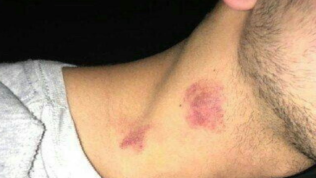 how to give a hickey to your boyfriend naturally - YouTube