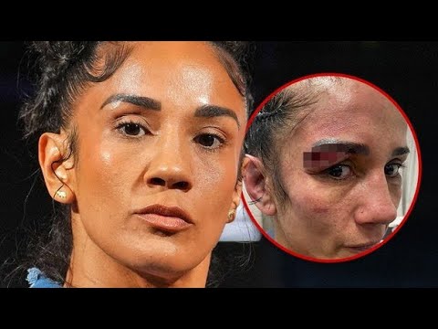 Amanda Serrano's Shocking Injury After Katie Taylor Fight! - YouTube