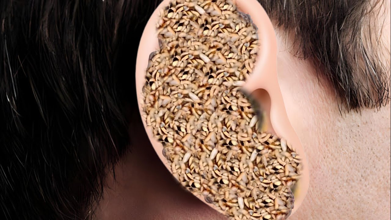 ASMR Ear, nose piercing treatment removes animation relax | ASMR ...