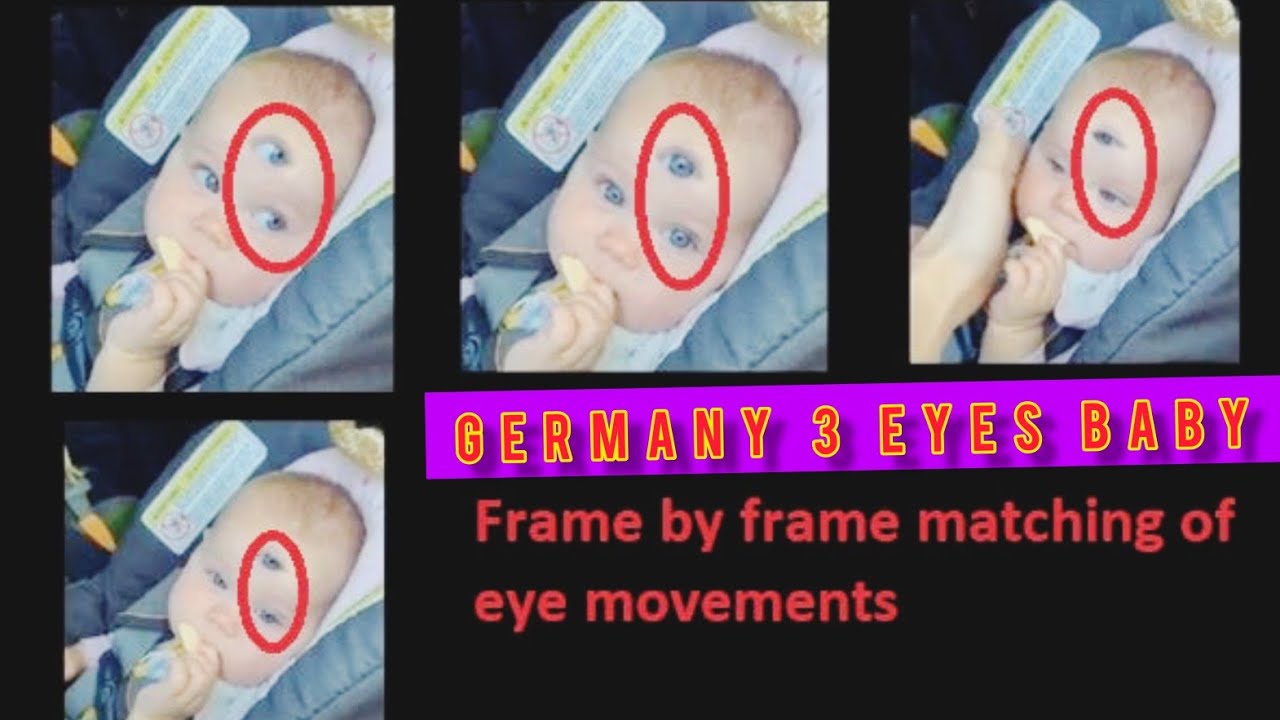GERMANY 3 EYES BABY,What is reality behind it? - YouTube