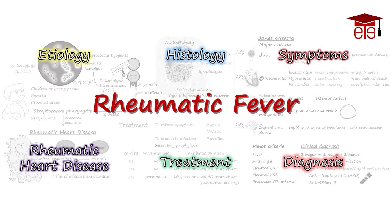 Rheumatic Fever || Etiology, Clinical Diagnosis, Complications and ...