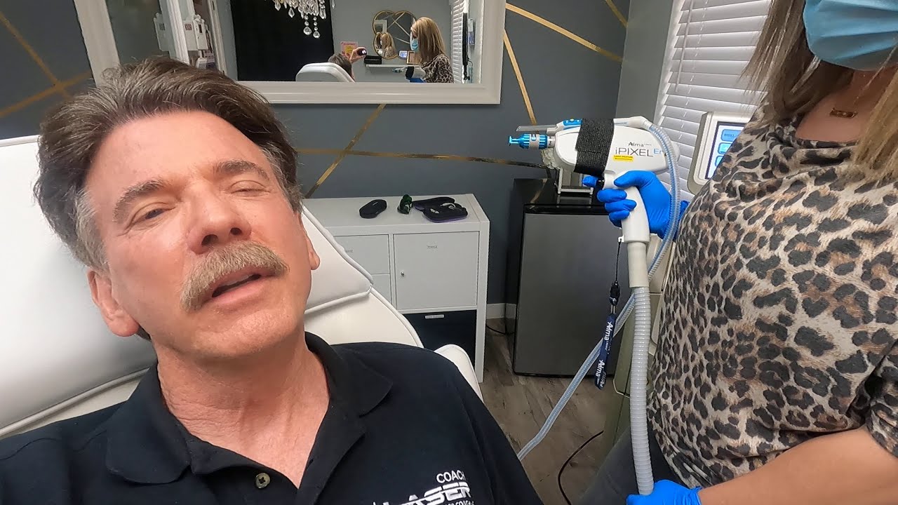 Alma Harmony XL Pixel Erbium treatment - YouTube