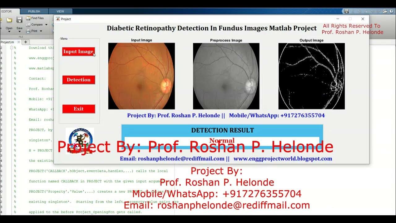 Diabetic Retinopathy Detection Using Image Processing Matlab Final Year Ieee Project Code