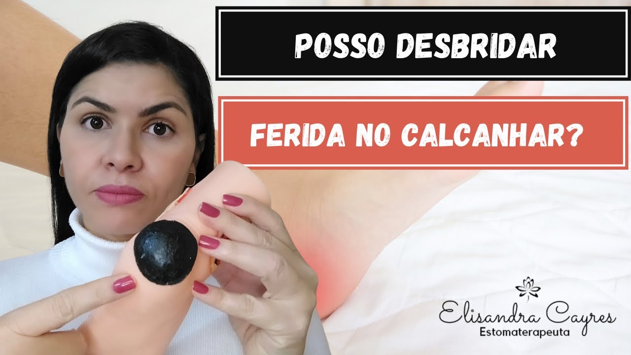NECROSE NO CALCÂNEO , POSSO DESBRIDAR? - YouTube
