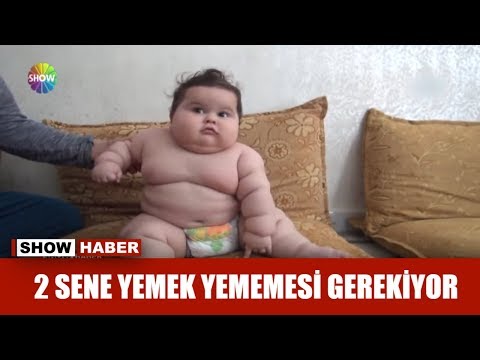 2 sene yemek yememesi gerekiyor