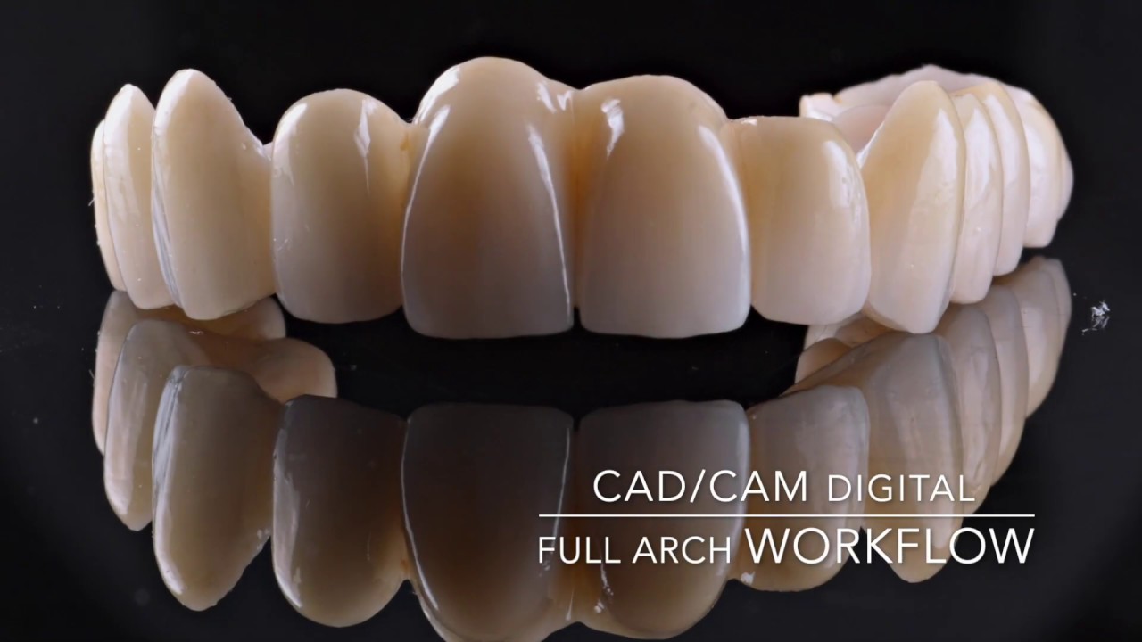 Full Contour Bridge Design Zicronia/Cutback CS3 3600 Amann Girrbach ...
