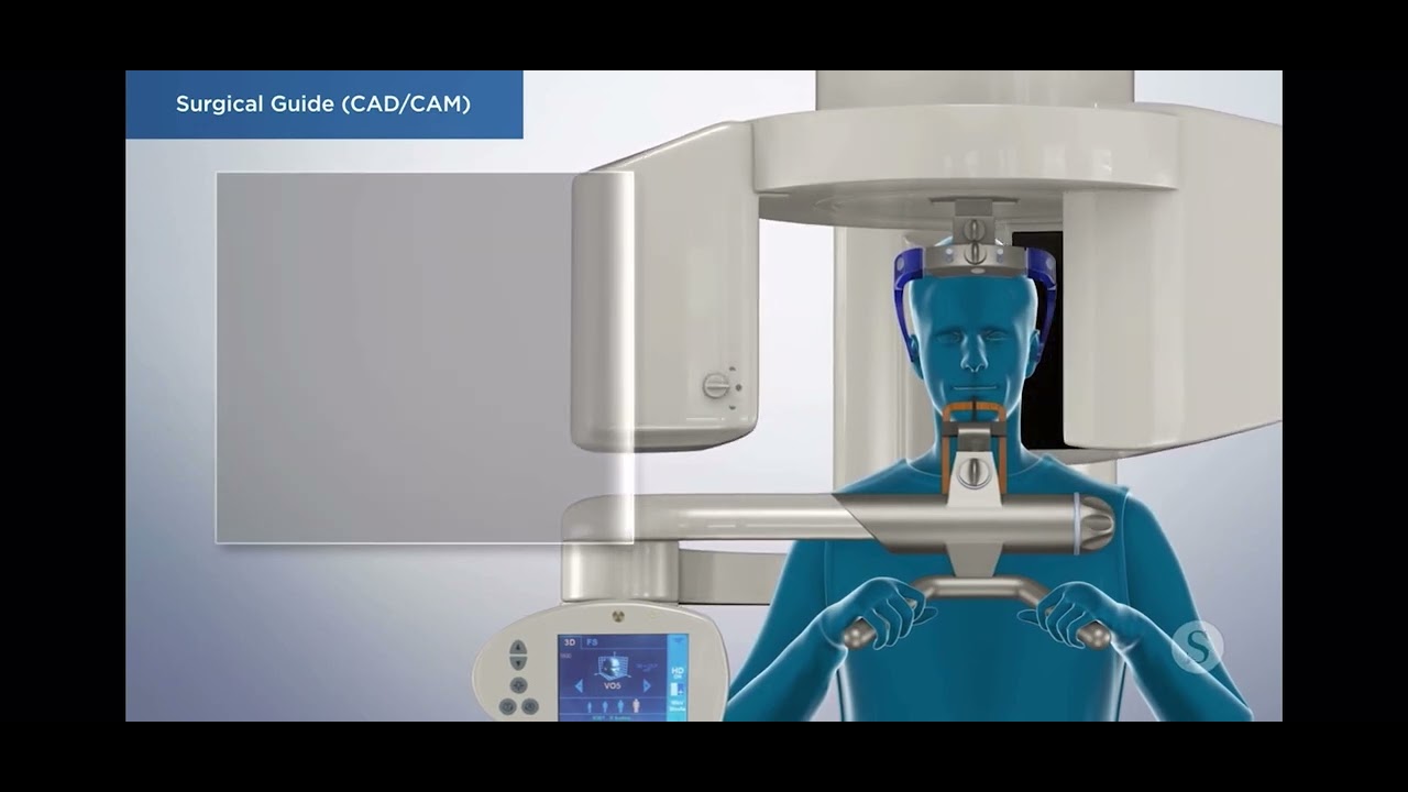 Surgical guide (CAD/ CAM) - YouTube