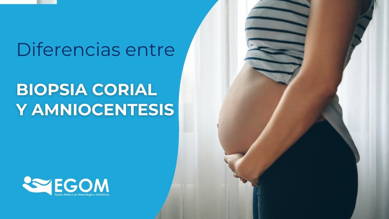 🧬 Diferencias entre la biopsia corial y la amniocentesis. Te explicamos ...