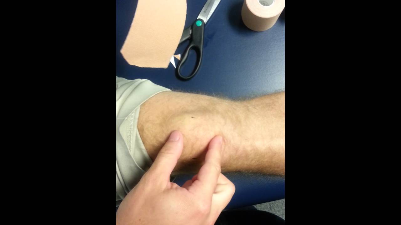 K tape for patella tracking - YouTube