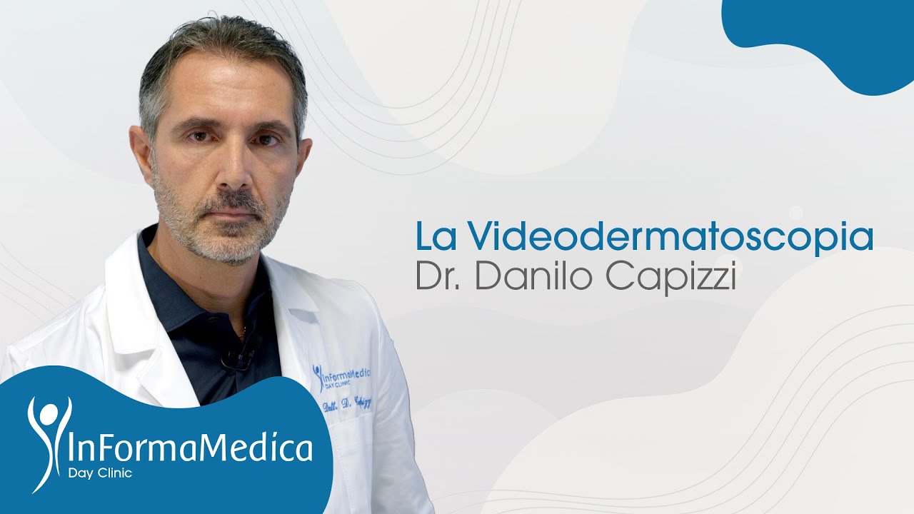 InformaMedica - La Videodermatoscopia - Dr. Danilo Capizzi - YouTube