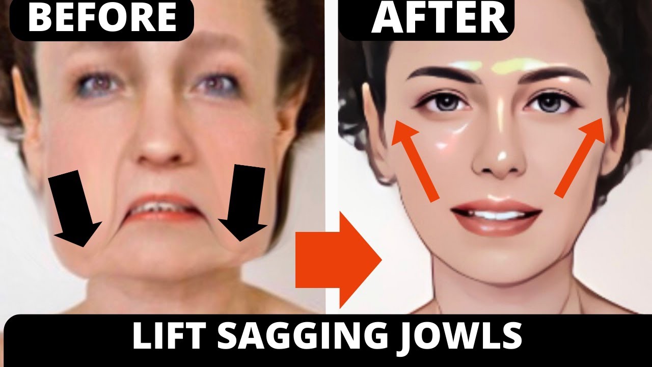 FACE REJUVENATION 35+ | ANTI-AGING EXERCISES FOR SAGGING SKIN, LAUGH ...