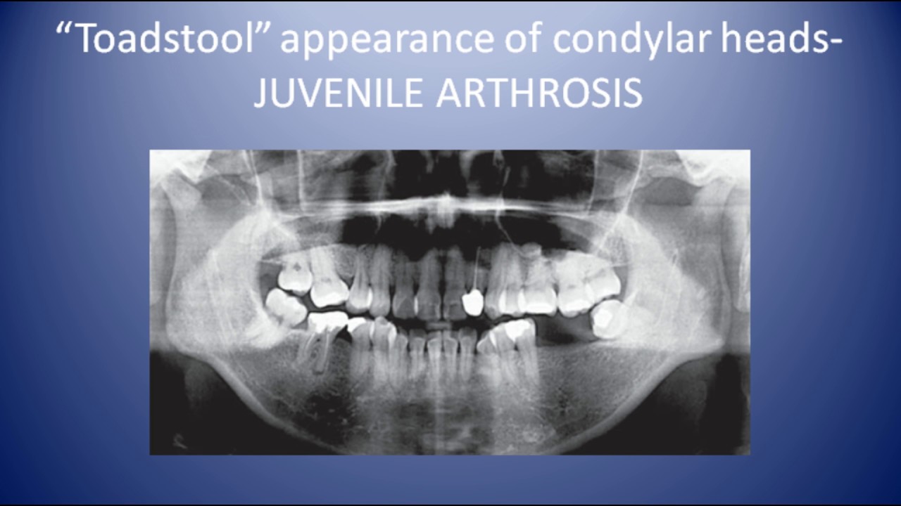 Maxillofacial radiology - YouTube