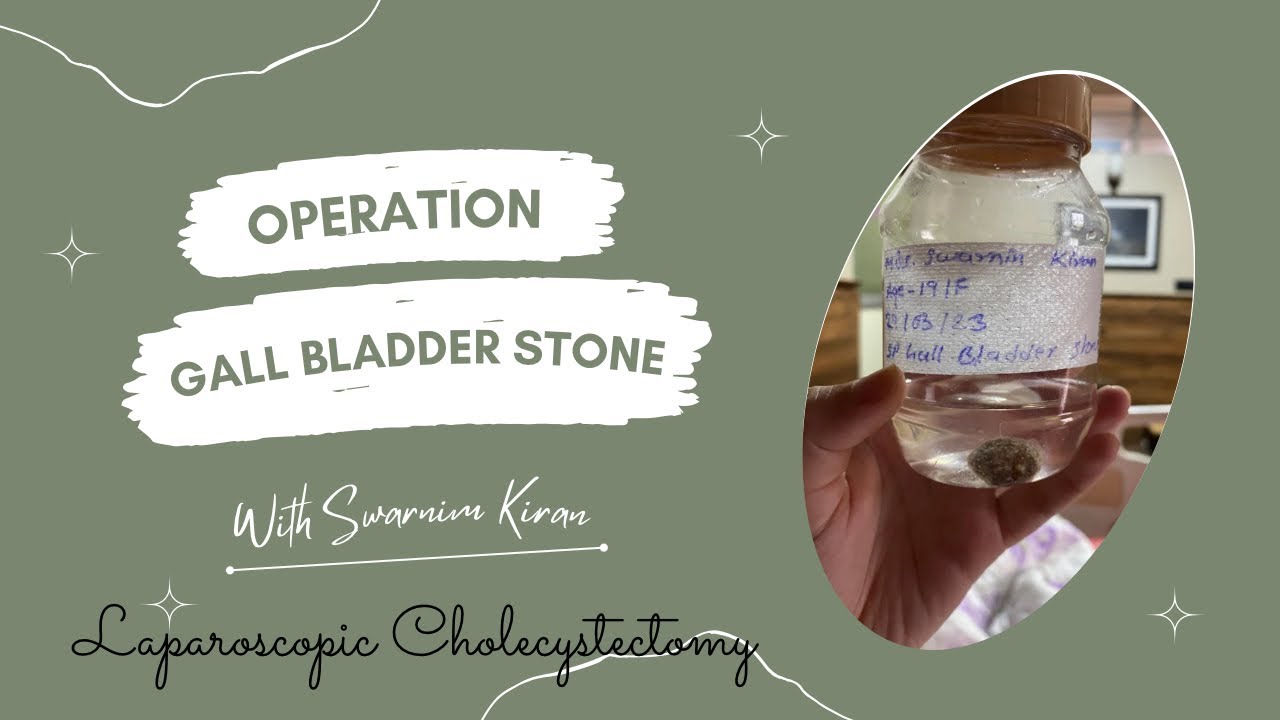 I HAD MY SURGERY!!! Gall bladder stone removal :) - YouTube