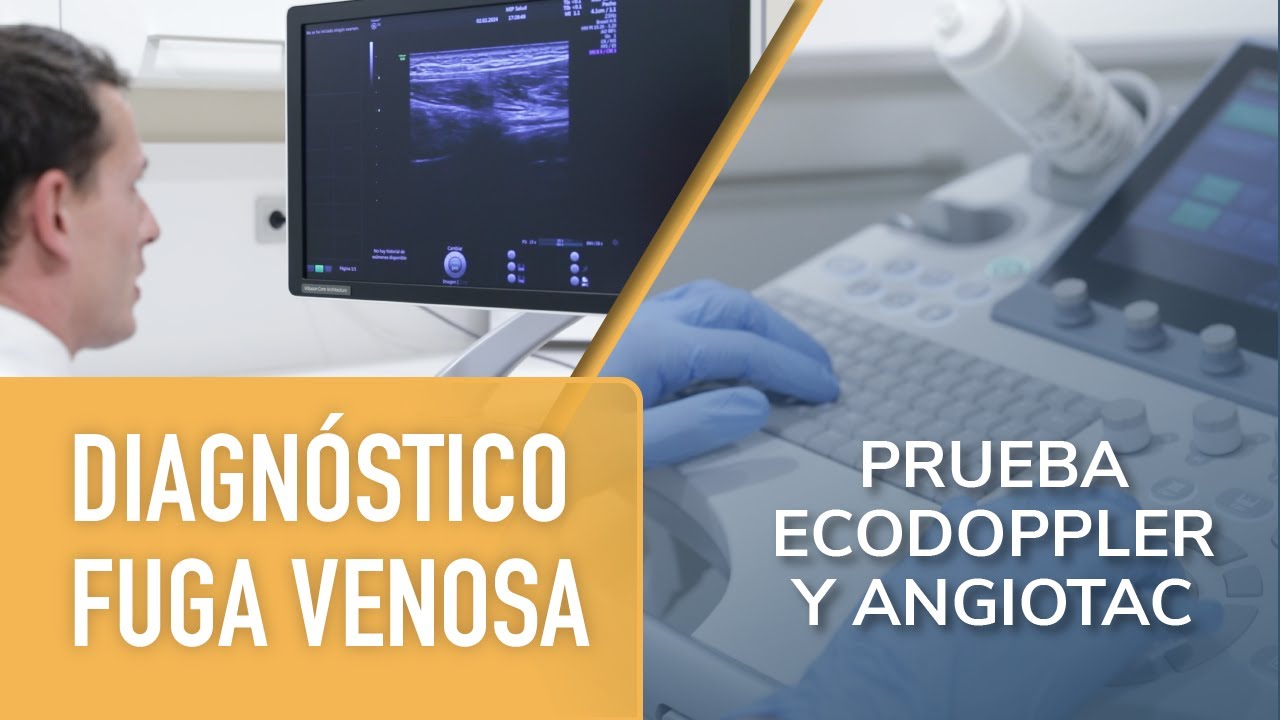 Diagnosticar la fuga venosa del pene. Eco-Doppler y Angiotac. Doctor ...