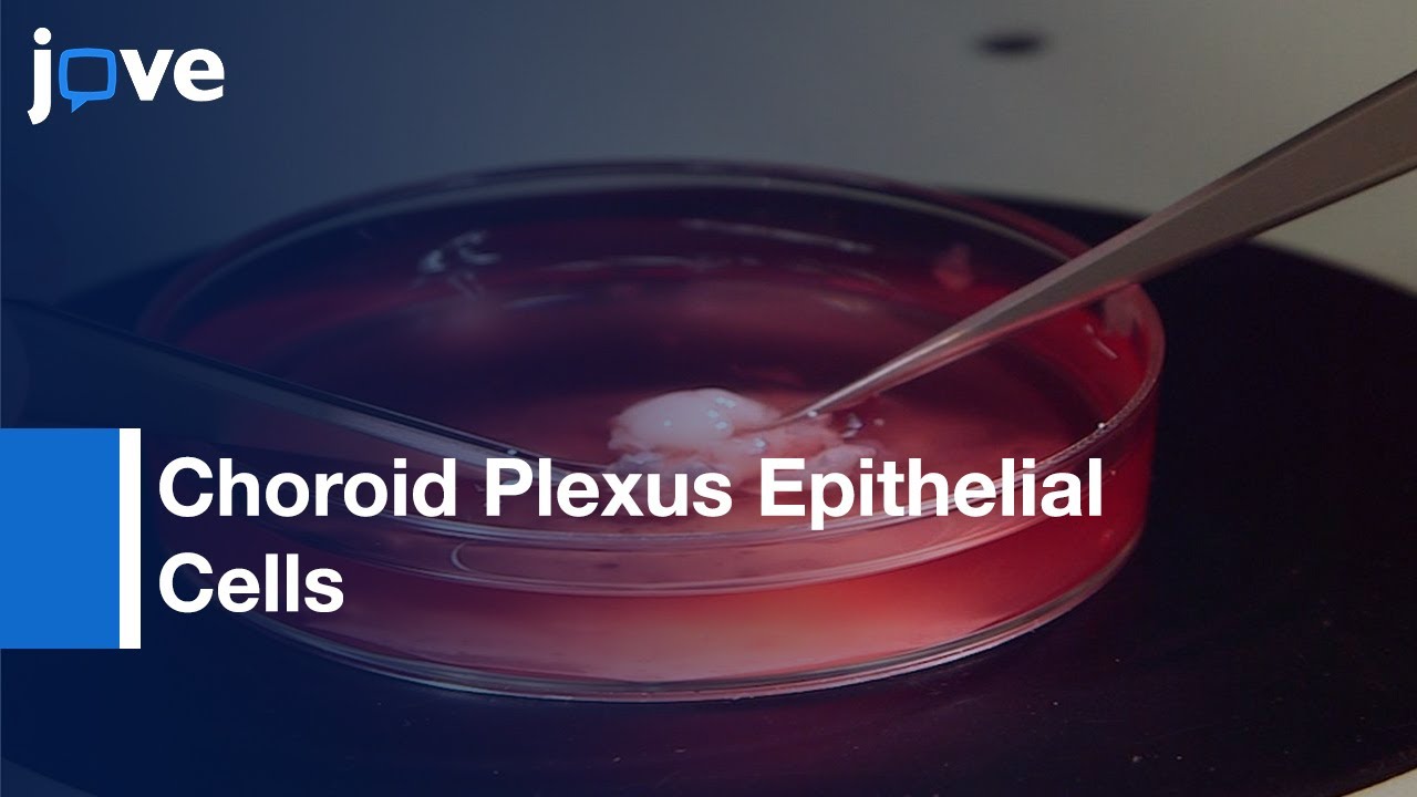 Choroid Plexus Epithelial Cells Movement Observation | Protocol Preview ...