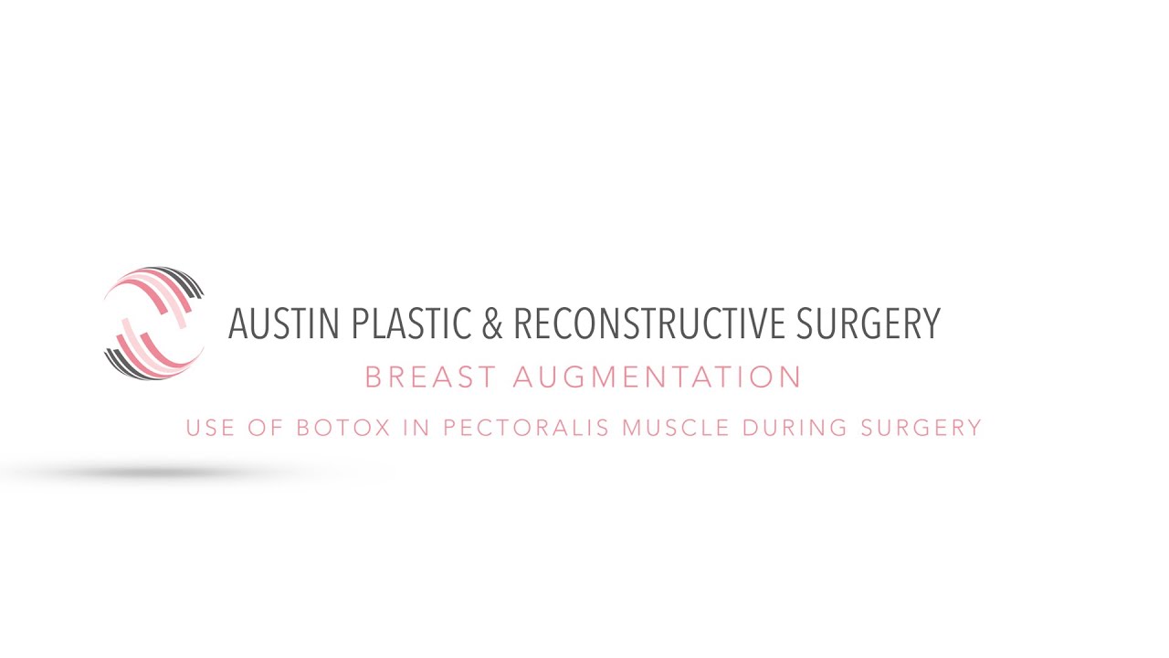 Breast Augmentation: Use of Botox in Pectoralis Muscle During Surgery ...