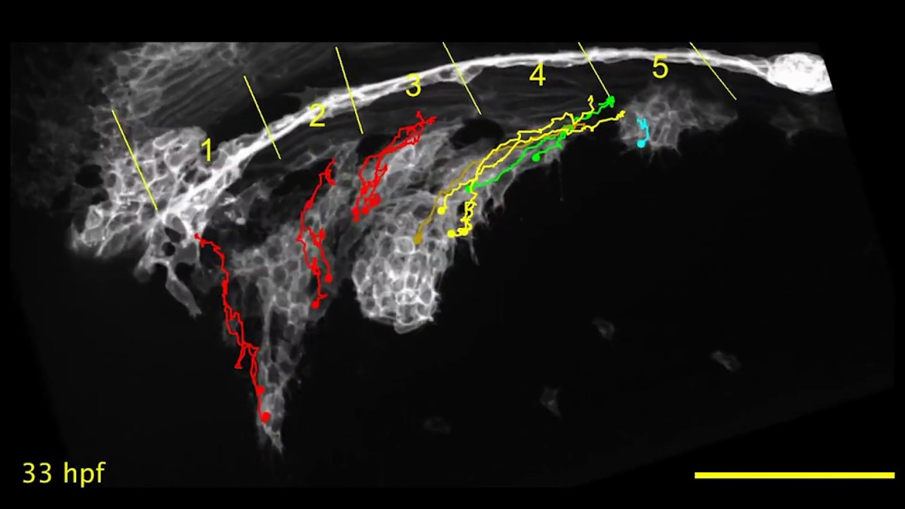 Making muscle in zebrafish: momentous migration of muscle precursors ...