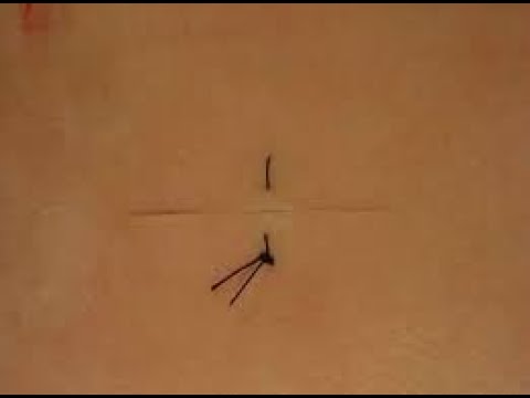 SUTURAS: PUNTO COLCHONERO VERTICAL (Lejos-lejos, cerca- cerca) - YouTube