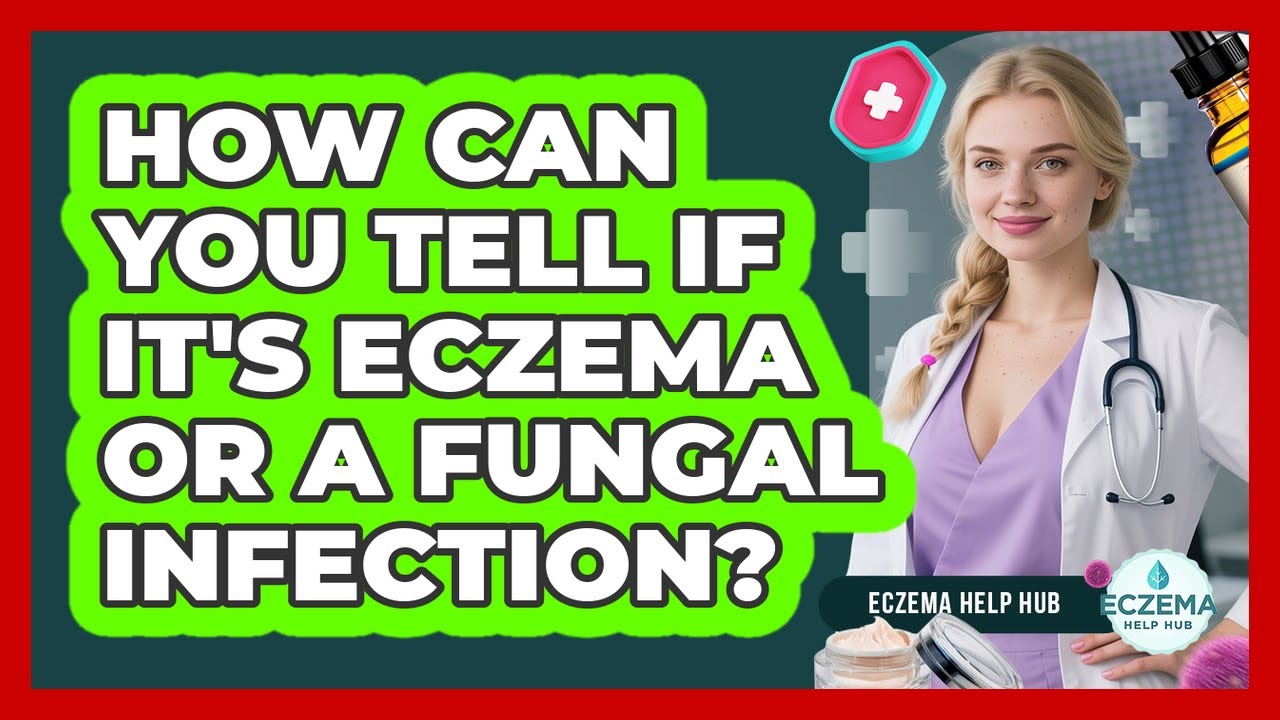 How Can You Tell If It's Eczema Or A Fungal Infection? - Eczema Help ...