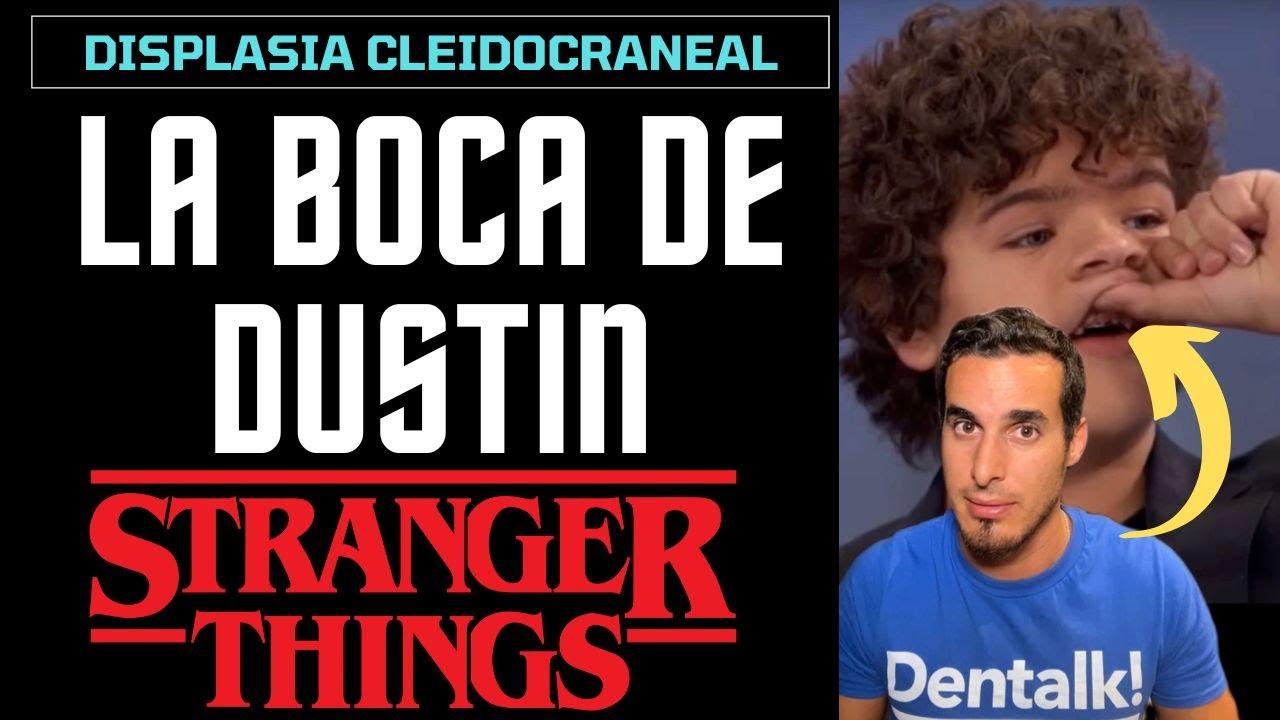 STRANGER THINGS ¿Qué le pasa a Dustin en los dientes? La extraña ...