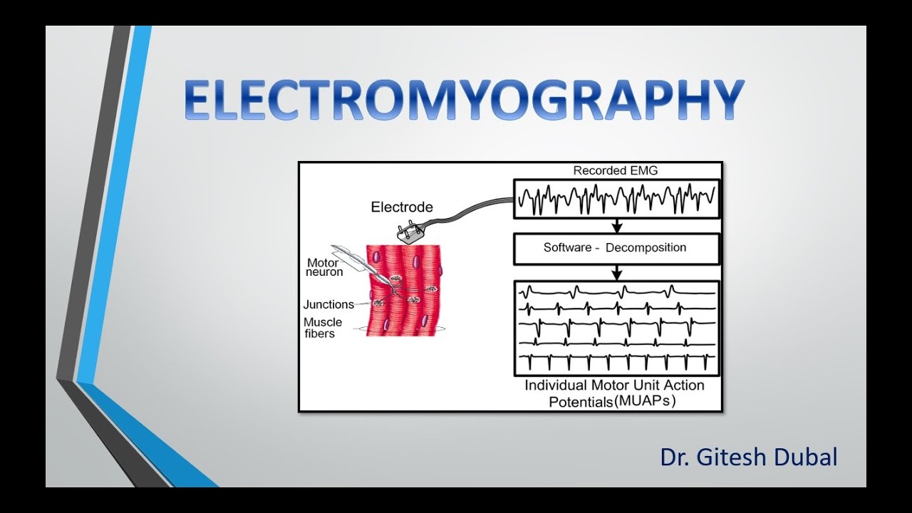 Electromyography (EMG) - YouTube