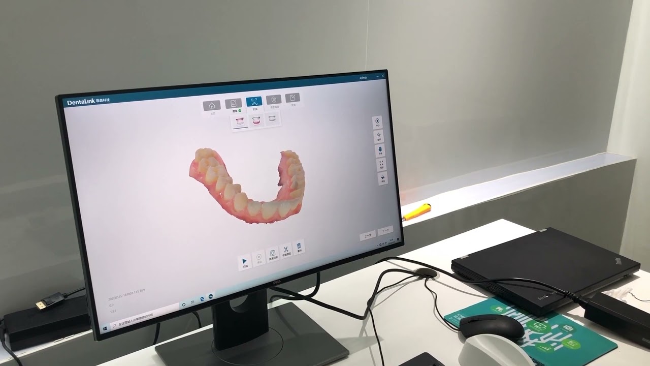 s6000 scanner intraoral fussen - Biotech ltda - YouTube