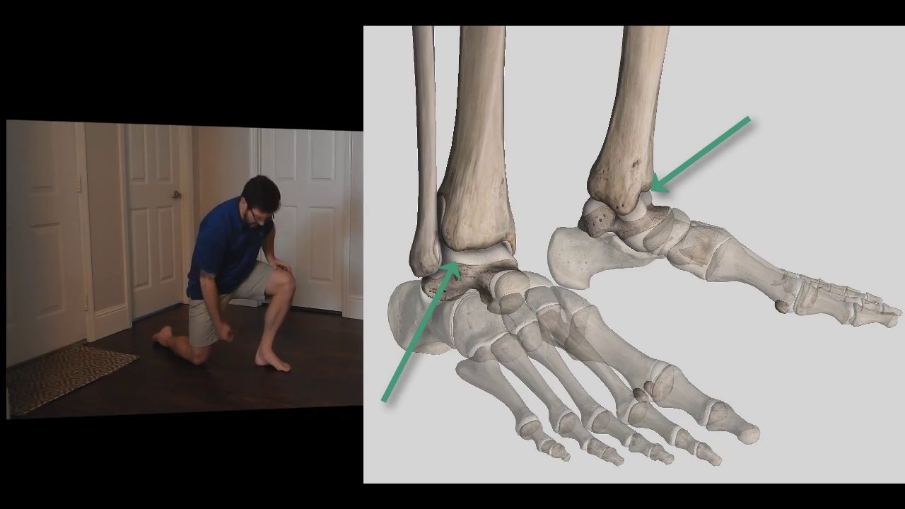 Education and common self treatments for high arches - YouTube