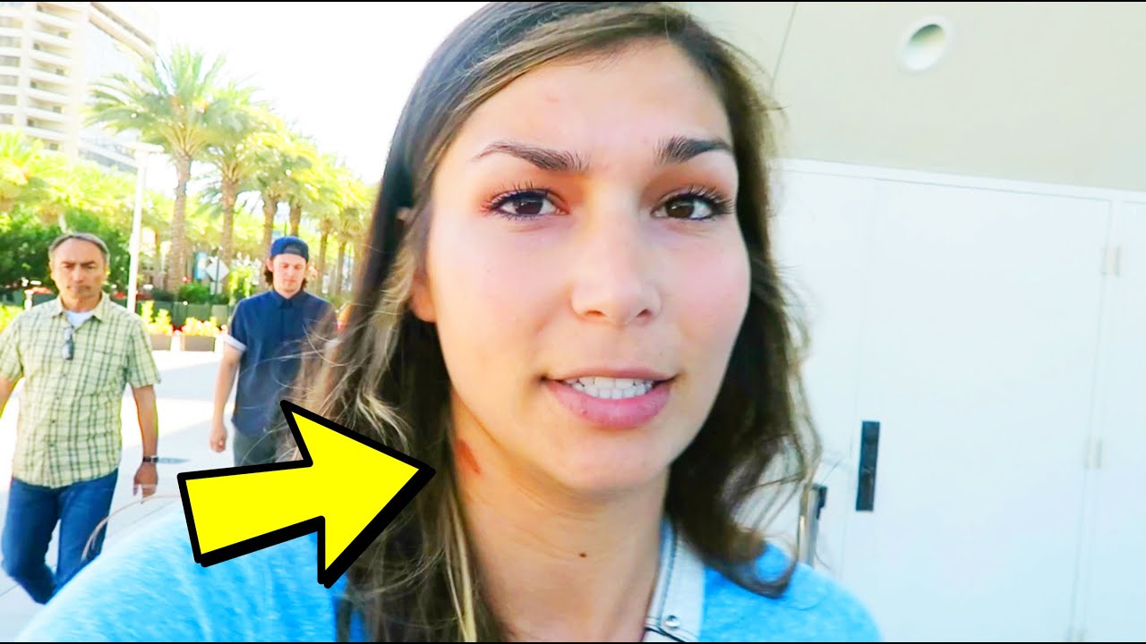 IT'S NOT A HICKEY! - YouTube
