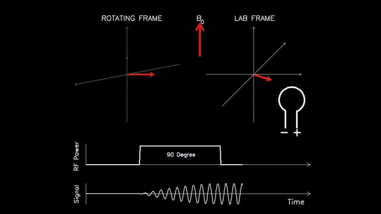 MRI: Physics and Image Creation - 90 Degree Spin Flip (Part 3/18) - YouTube