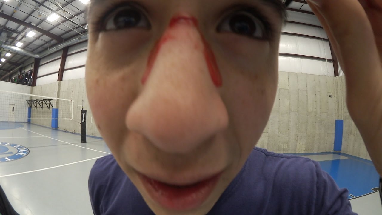 SPLIT HIS NOSE OPEN - YouTube