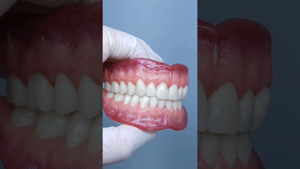smile creation in prosthodontics.#shorts #viral #trending #bds # ...