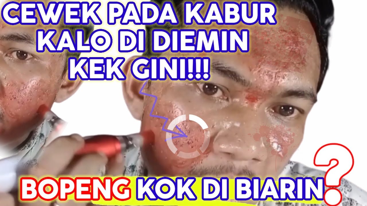 Tutorial Ampuh Atasi Bopeng Dermapen Di Rumah Part 1⃣ - YouTube