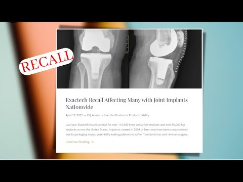 Exactech Recall Affecting Many with Joint Implants Nationwide - YouTube