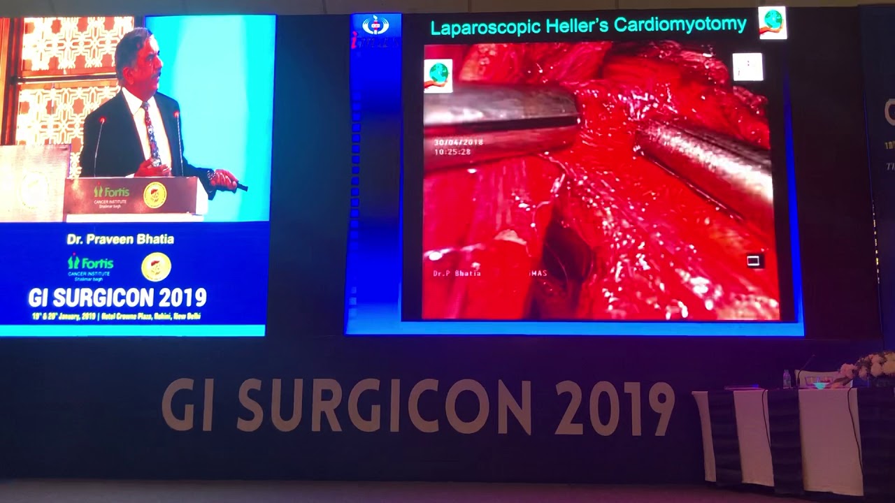Achalasia Cardia: Failed myotomy, failed fundoplication: What to do ...
