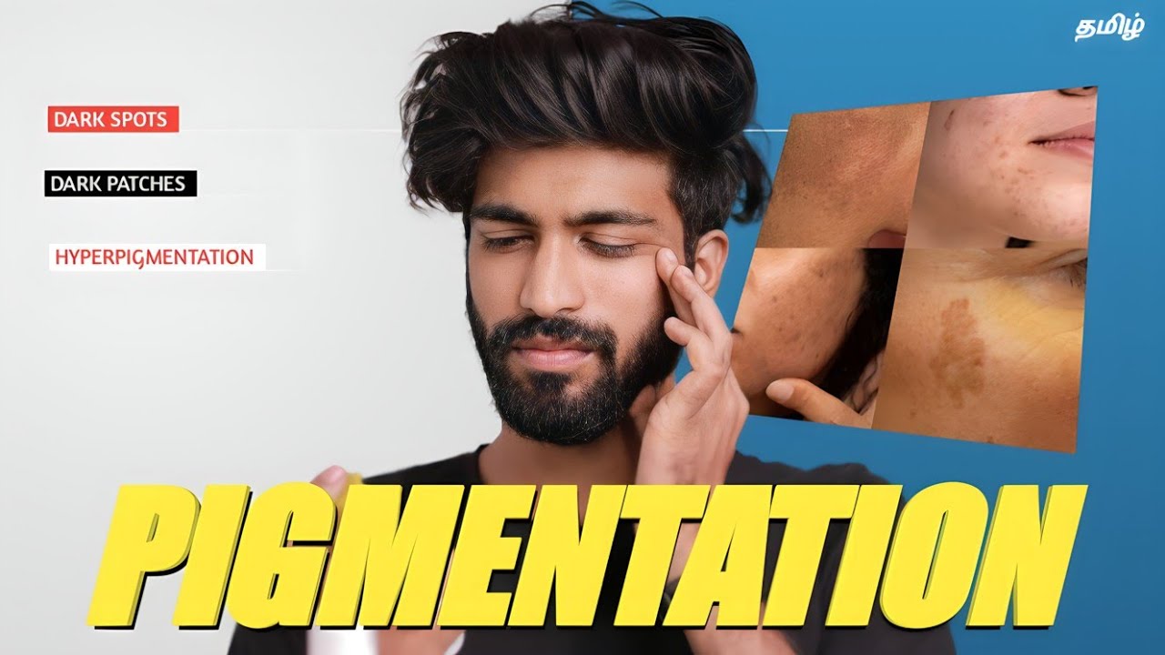 How To Remove DARK SPOTS HYPERPIGMENTATION The Right Way how-to-remove-dark-spots-hyperpigmentation-the-right-way