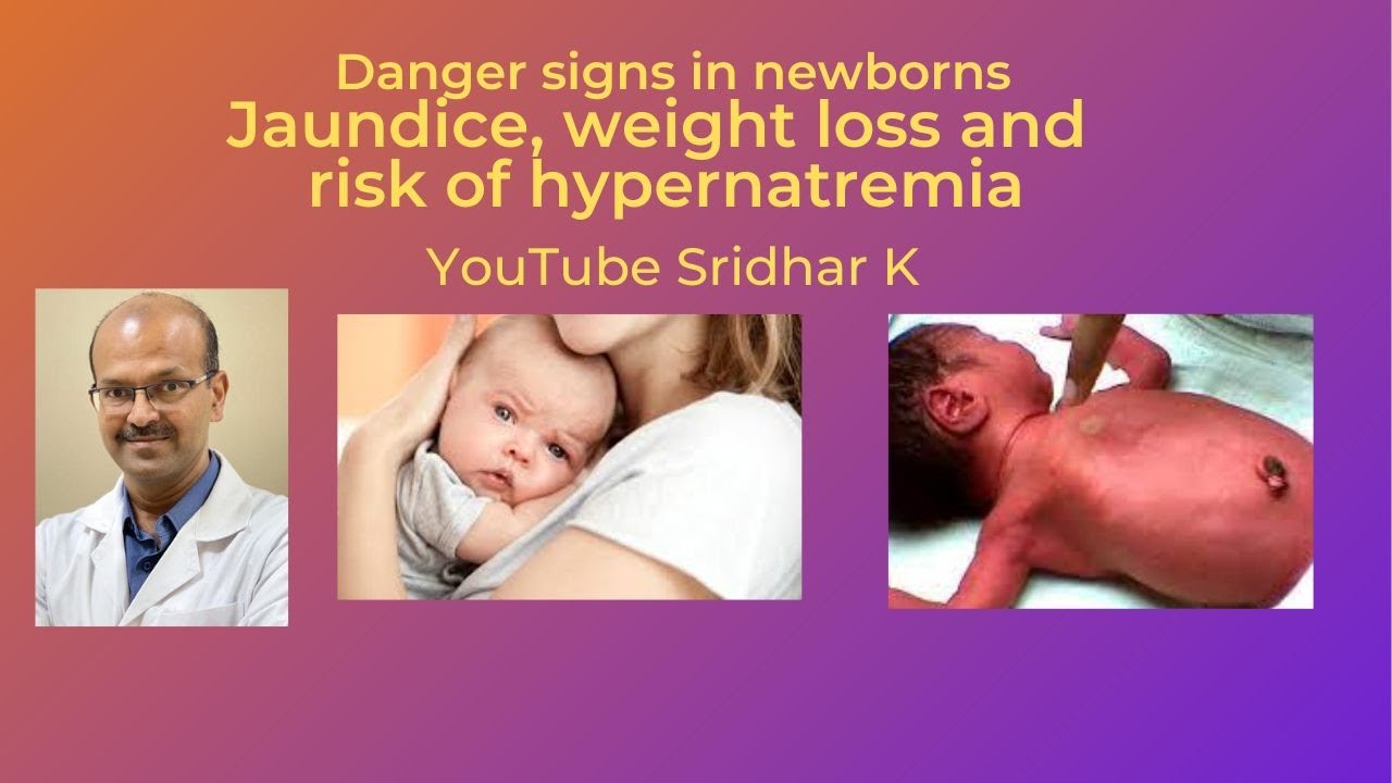 Jaundice Baby Symptoms