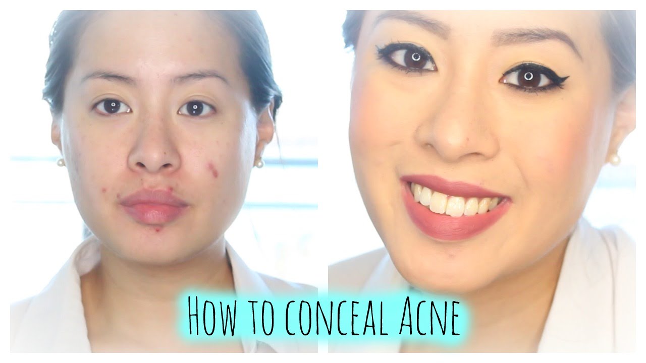 How To Conceal Acne With Makeup | IT Cosmetics Bye Bye Redness ...