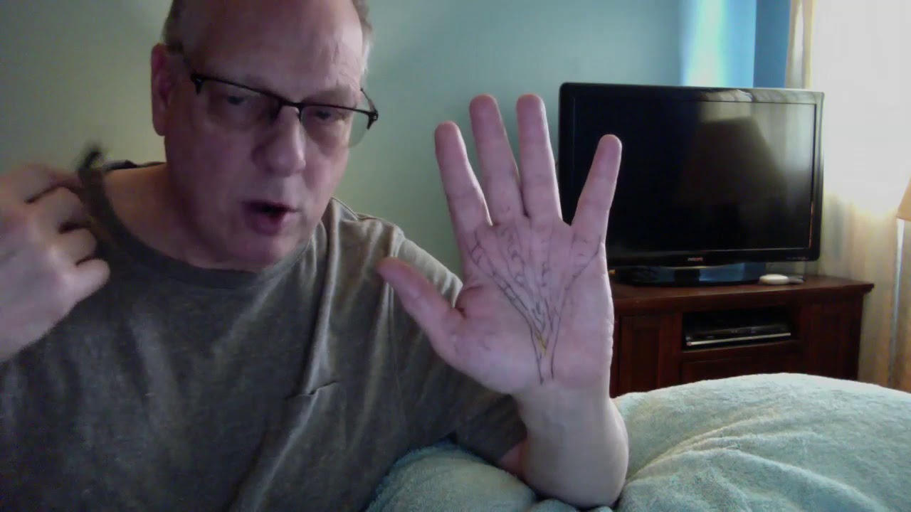 Stay Home massage part #5 trigger finger - YouTube