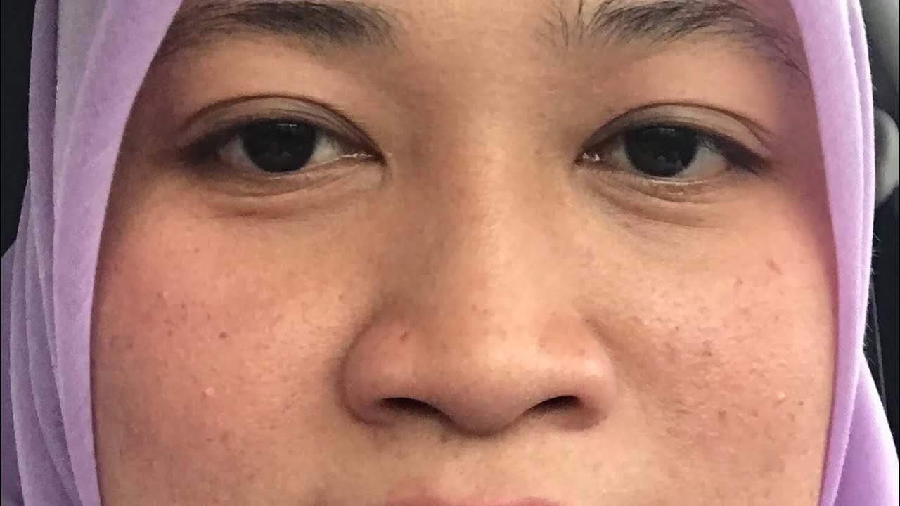 Cara sejukkan badan (panas dalam) - YouTube