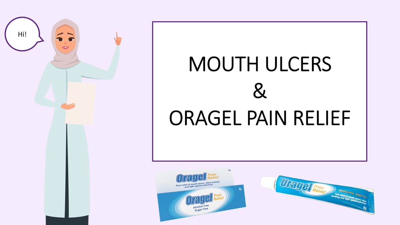 Mouth ulcers and how to treat it - YouTube