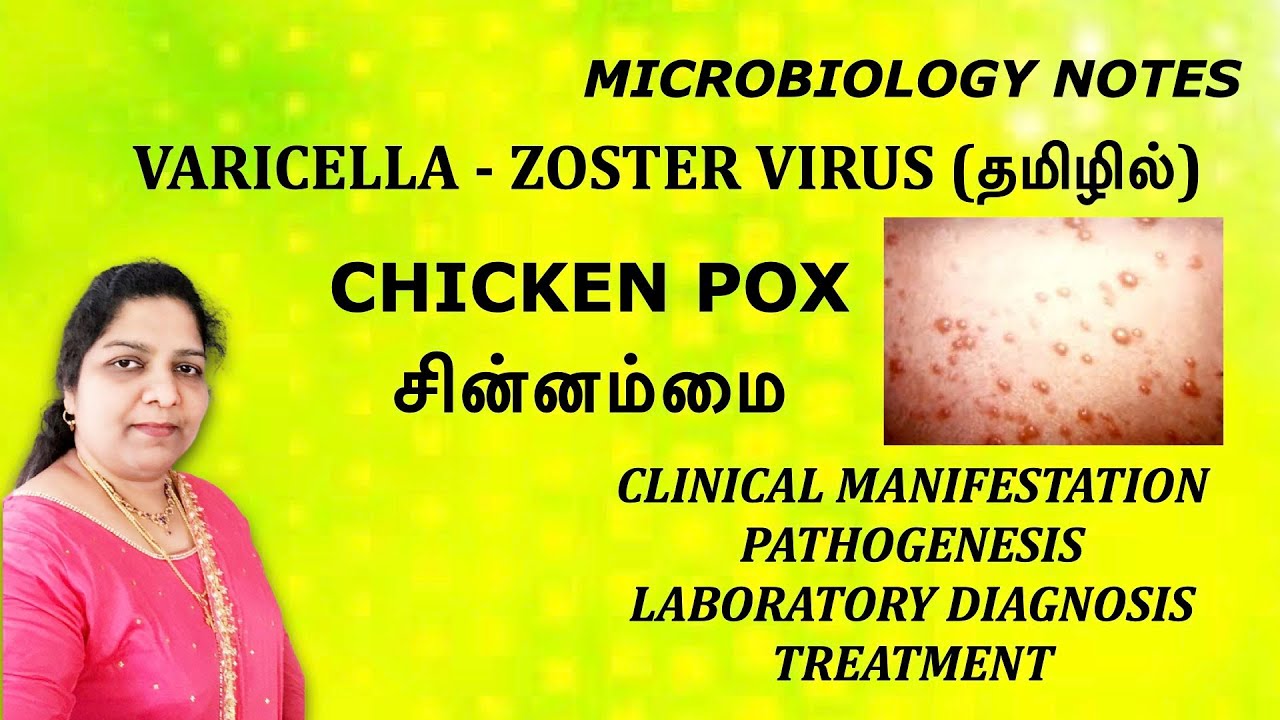 Varicella Zoster Virus Chicken Pox Shingles Pathogenesis Lab varicella-zoster-virus-chicken-pox-shingles-pathogenesis-lab