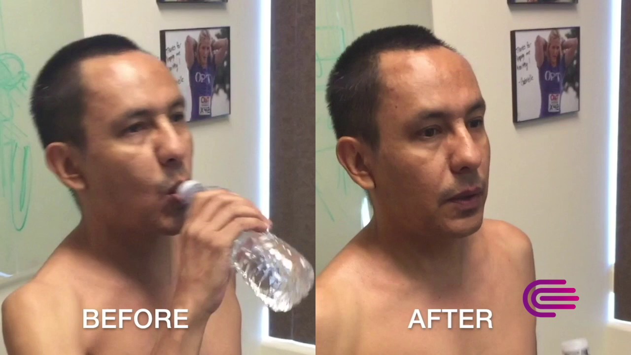 David Before After - YouTube