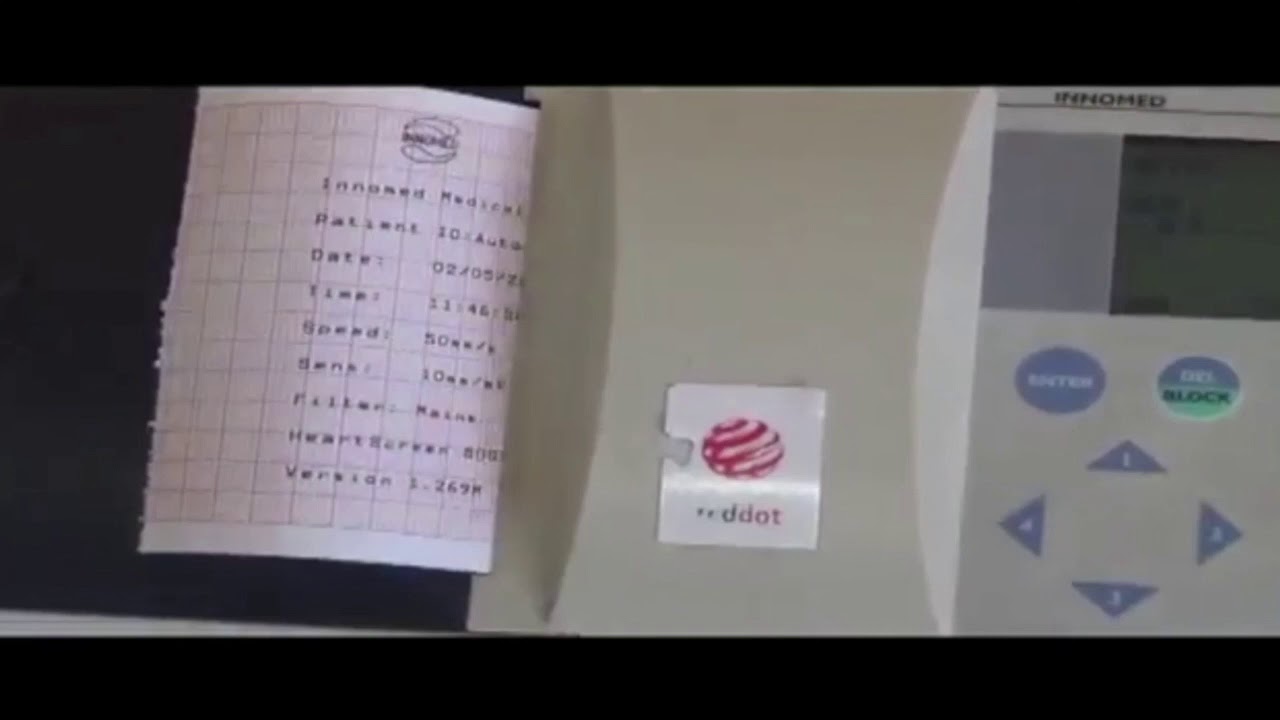 Registration of ECG - YouTube