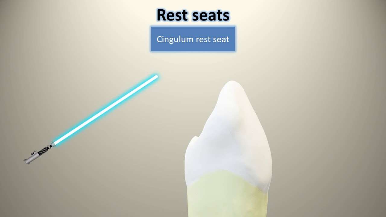 Cingulum rests preparation guidelines - YouTube