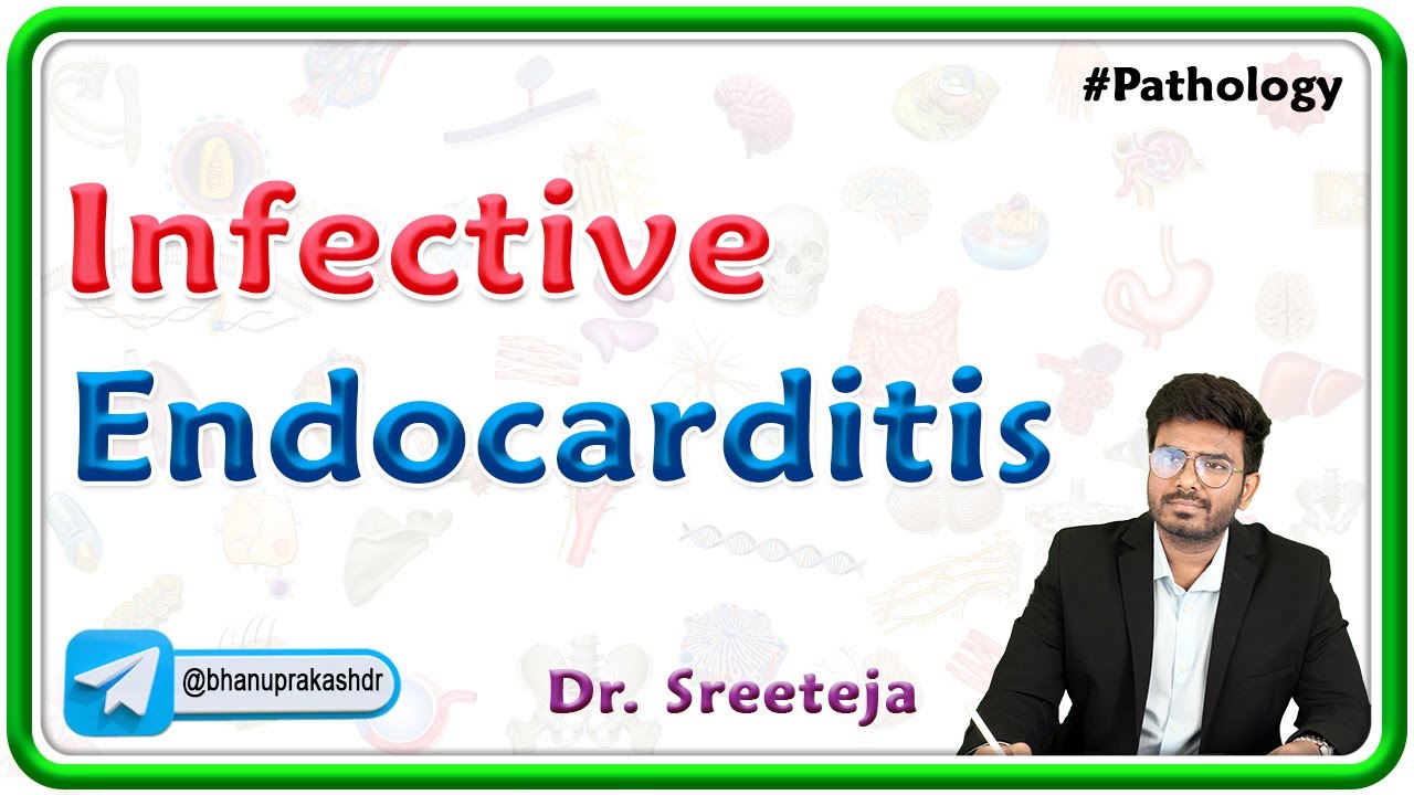 7: Infective Endocarditis : Pathology USMLE Step 1 - YouTube