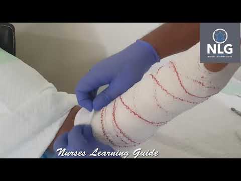 below elbow slab,volar splint/slab,short arm splint, - YouTube